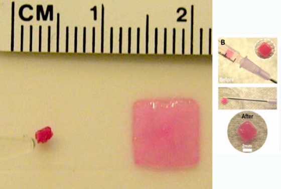 Injectable shape-memory sponge delivers drugs, cells, and structure ...